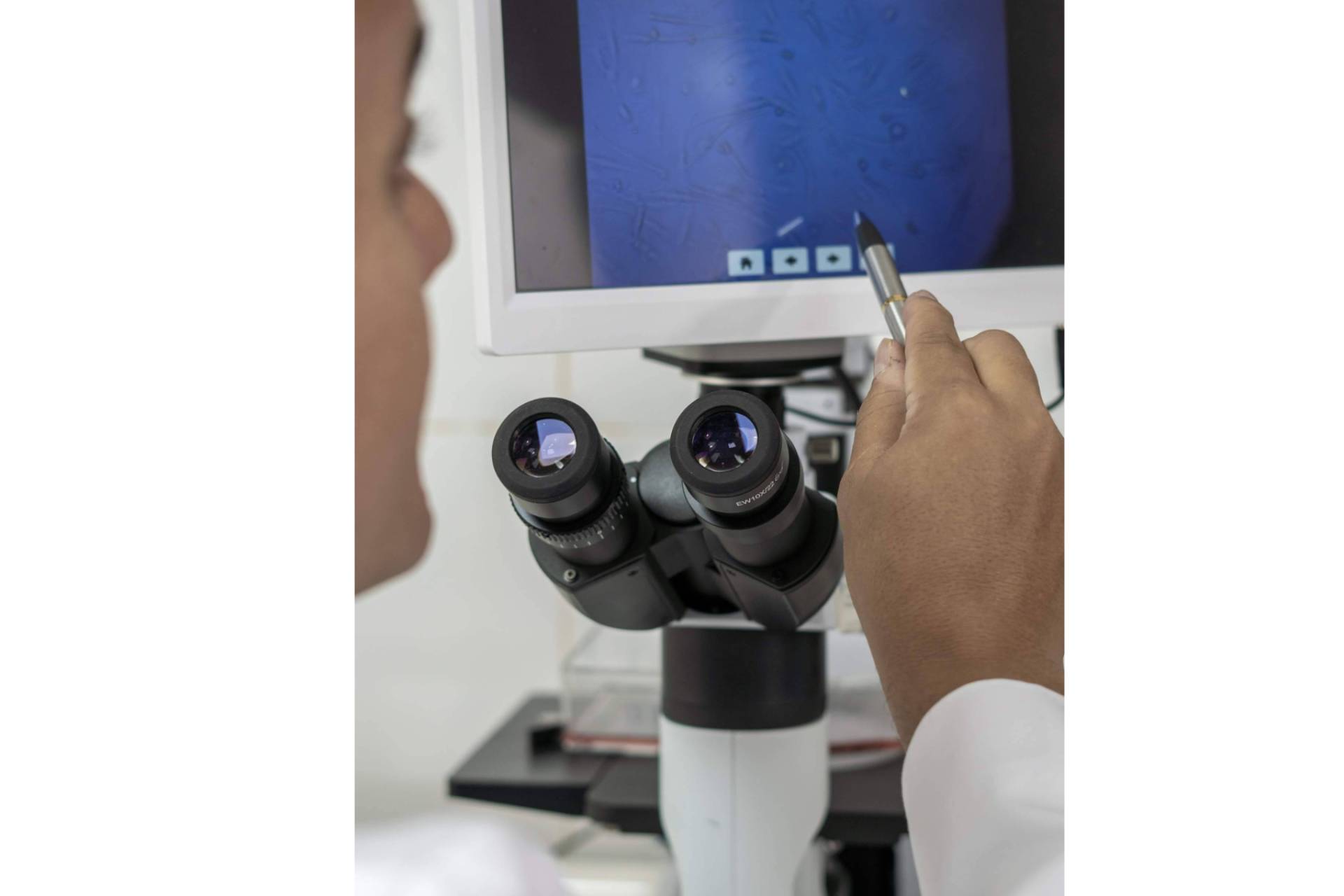 Cancer avanzado; El valioso aporte actual de la inmunoterapia DEX en el ...